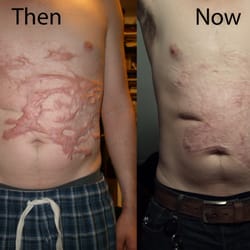 Michael Kulick, MD - 49 Reviews - Cosmetic Surgeons - 450 Sutter St ...