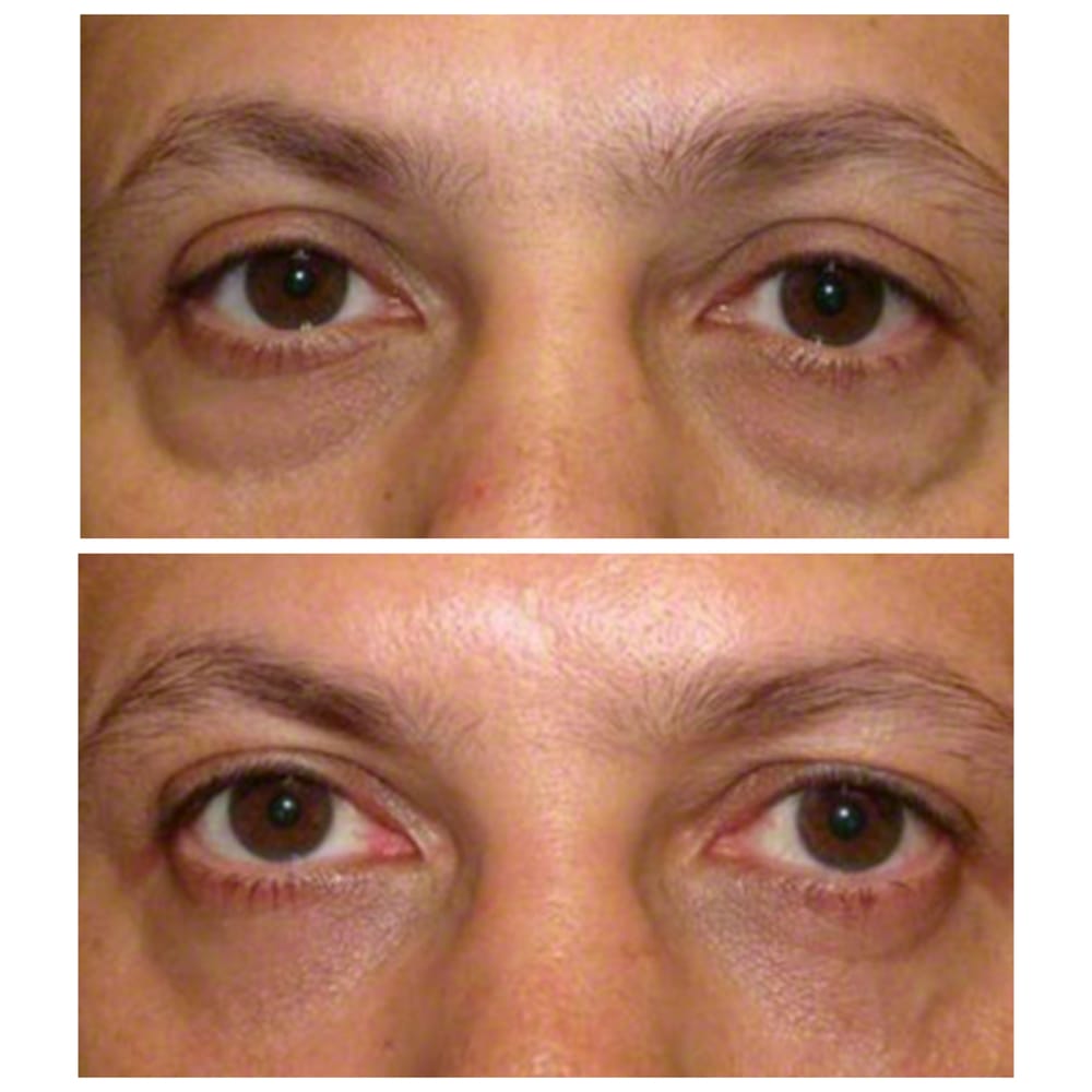 Guy Massry, MD - 42 Photos & 28 Reviews - Cosmetic Surgeons - 150 N ...